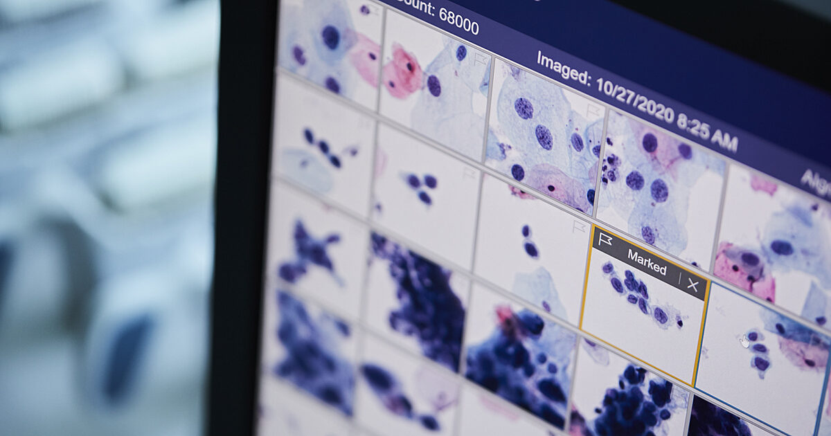 Hologic: AI-powered cervical cancer screening for all | Slalom Build